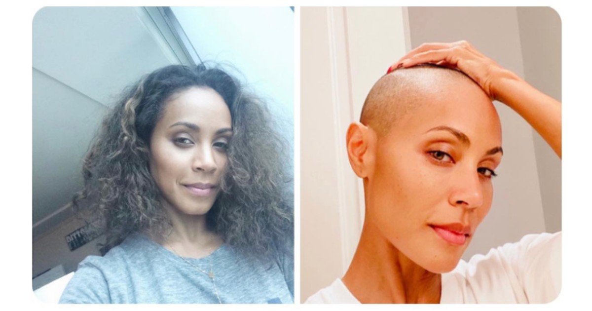 ¿Qué es la alopecia? Enfermedad que tiene Jada - HeyHeyHello!